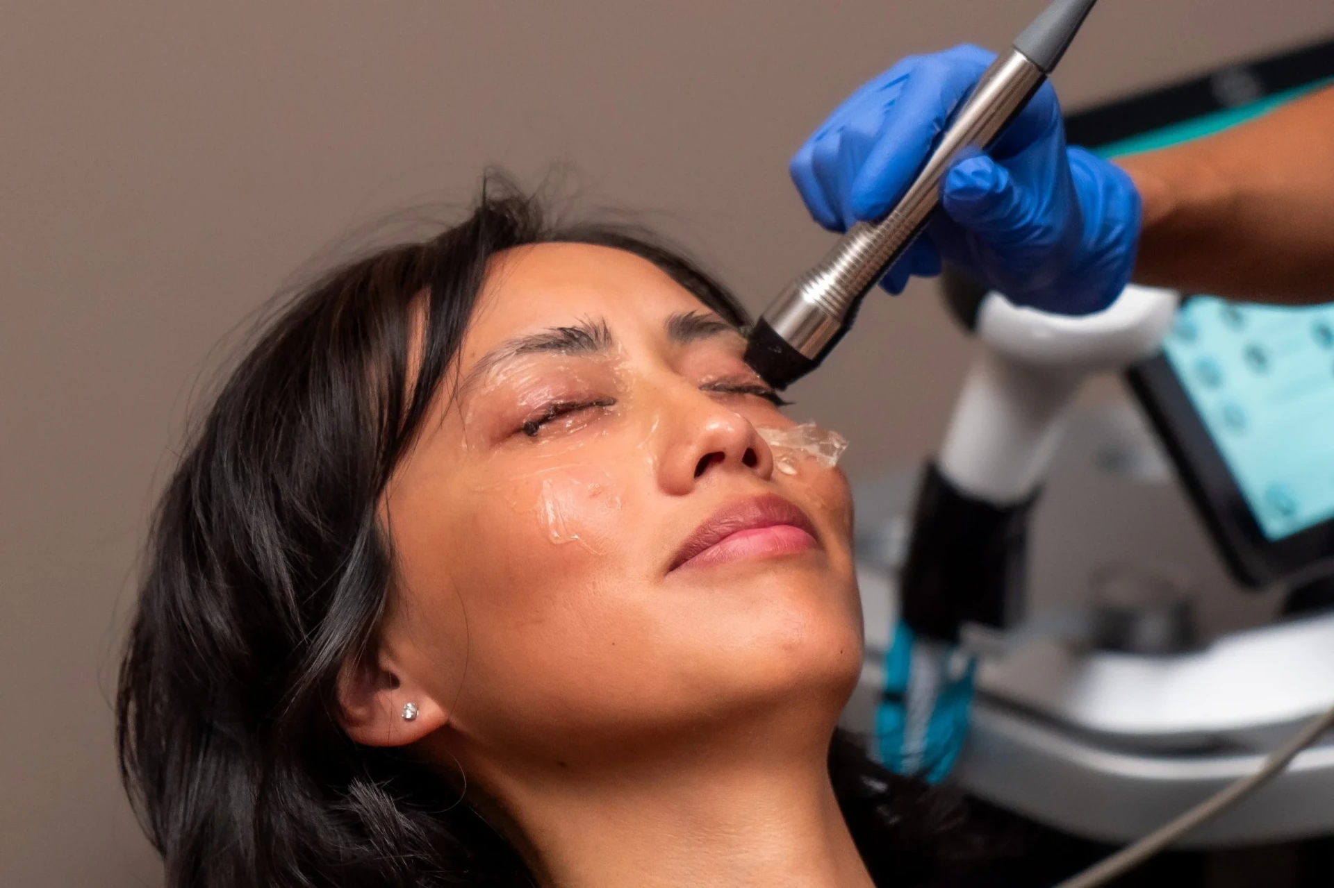 Advanced Dry Eye Treatment | InMode Technology | Lasting Relief